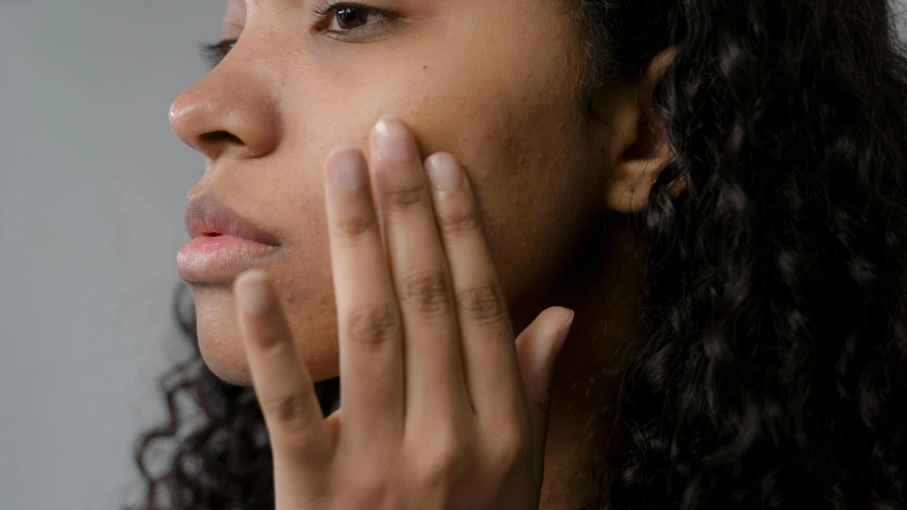 Exploring Hidradenitis Suppurativa Phenotypes and Treatments - MDNewsline