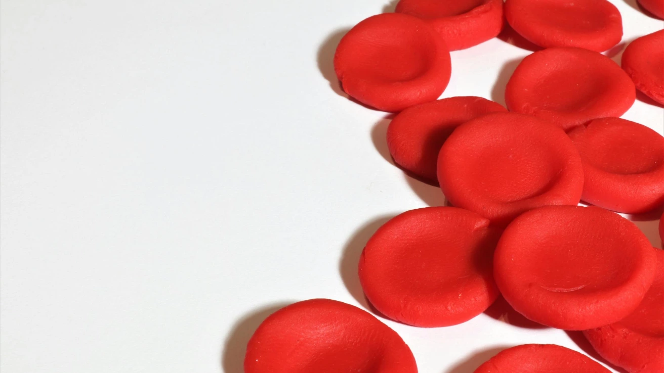 Study Finds Unique Pattern of Blood Clots in Sickle Cell Trait, but Low ...