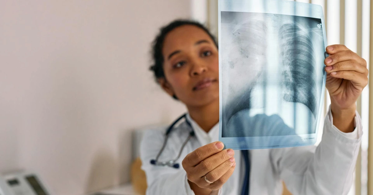 Progression Lesion Type Predicts Survival After NSCLC Progression ...