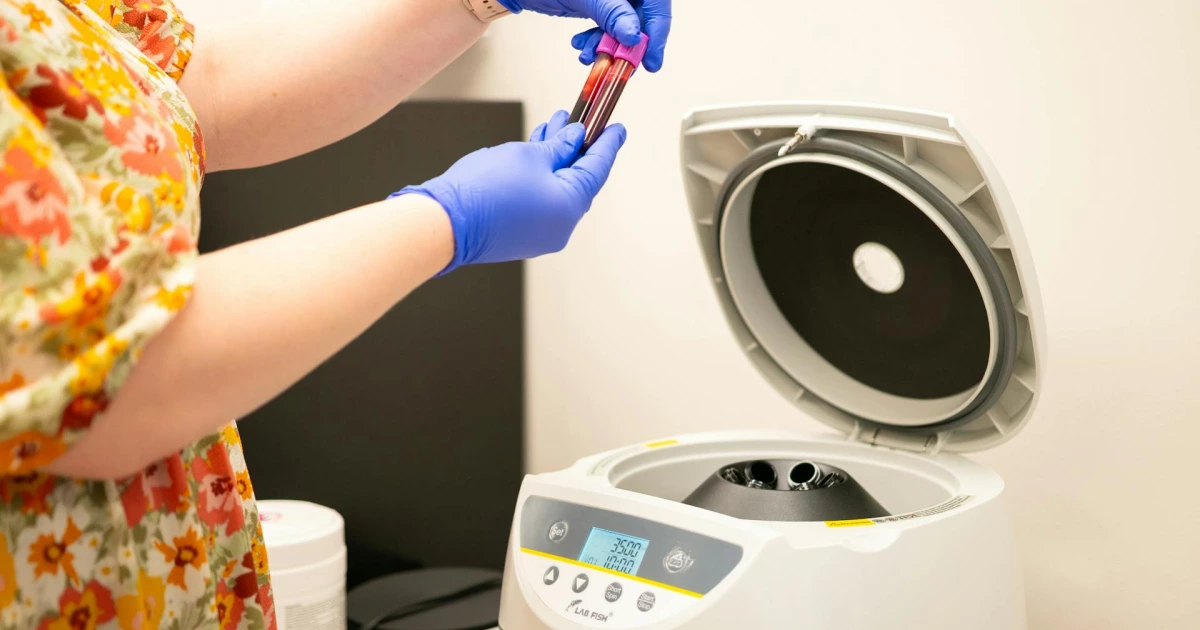 Lipoprotein-Specific Fatty Acid Profiles in Familial ...