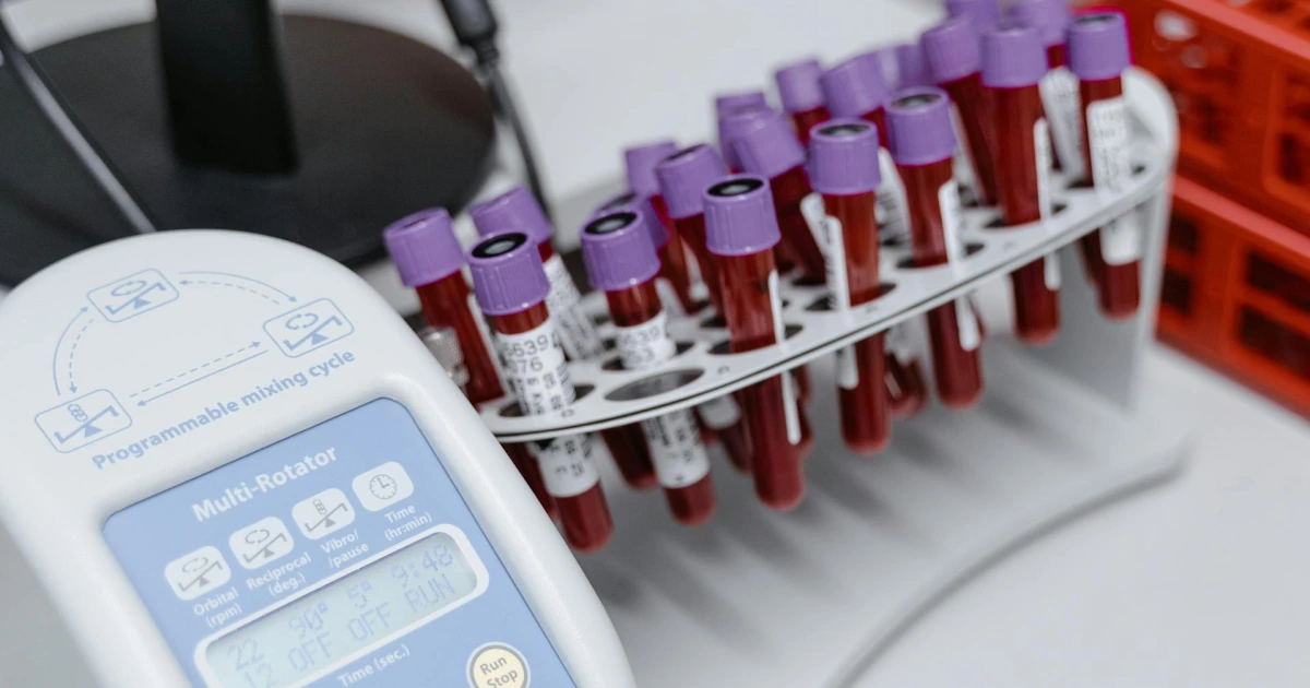 Patients With Myeloproliferative Neoplasm Face Elevated Lymphoid Cancer ...