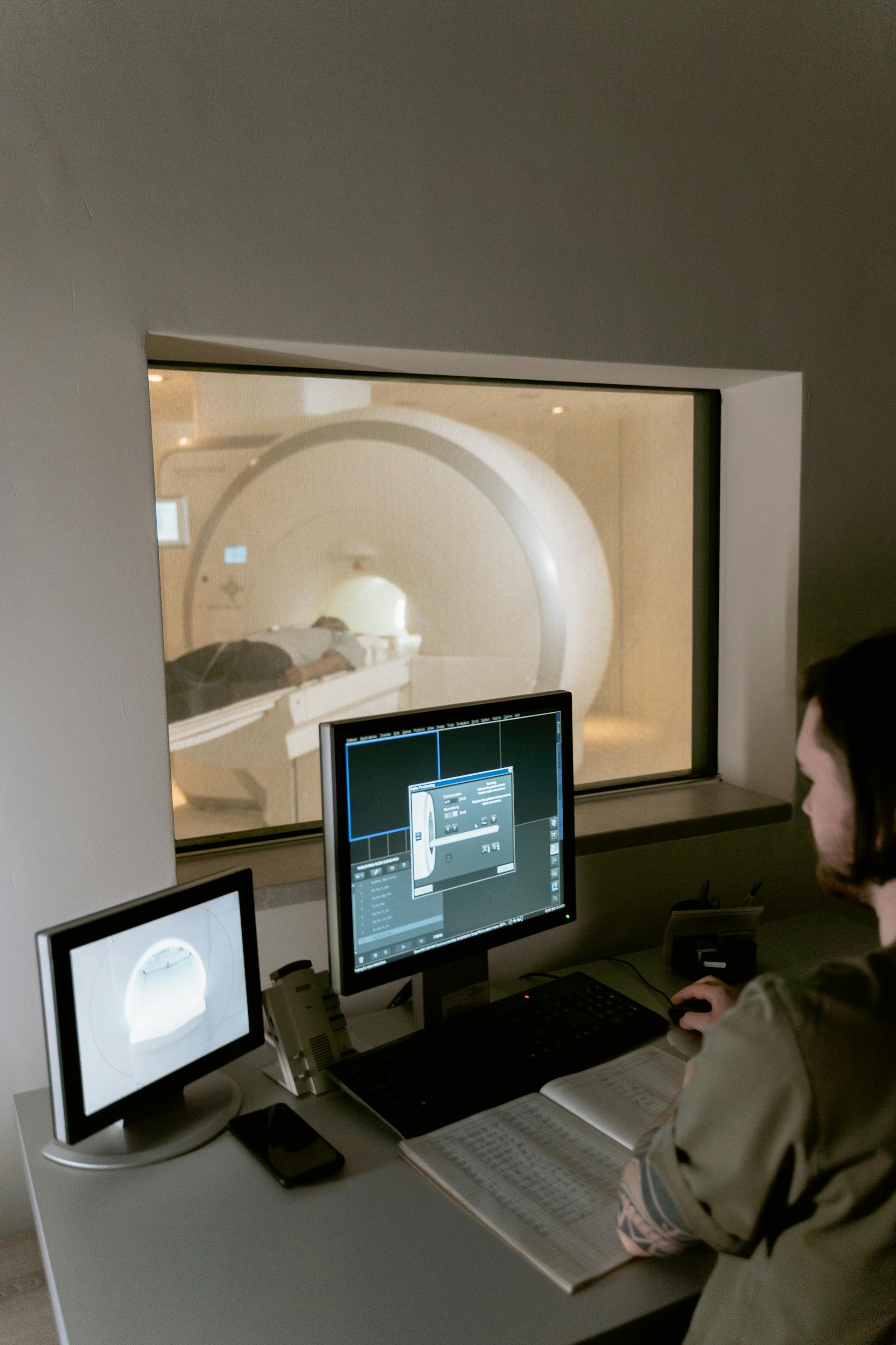 MRI Score for Monitoring Post-HIFU Prostate Cancer - MDNewsline